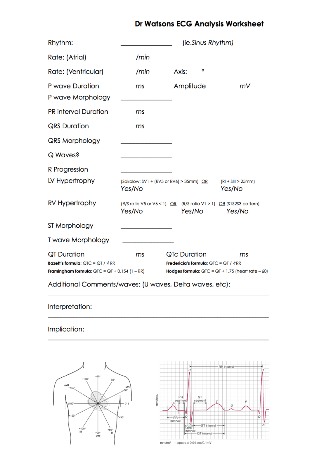 CME: ECG Analysis - Charlie's ED
