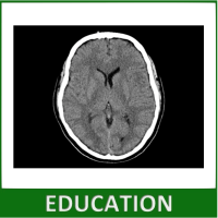CME 22/03/2018 - Approach to CT Head Imaging - Charlie's ED
