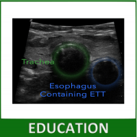CME 02/08/18 - US Confirmation of ETT Placement - Charlie's ED